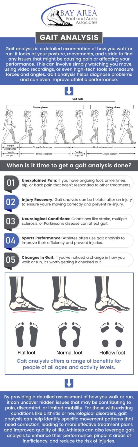 Video Gait Analysis | Bay Area Foot and Ankle Associates